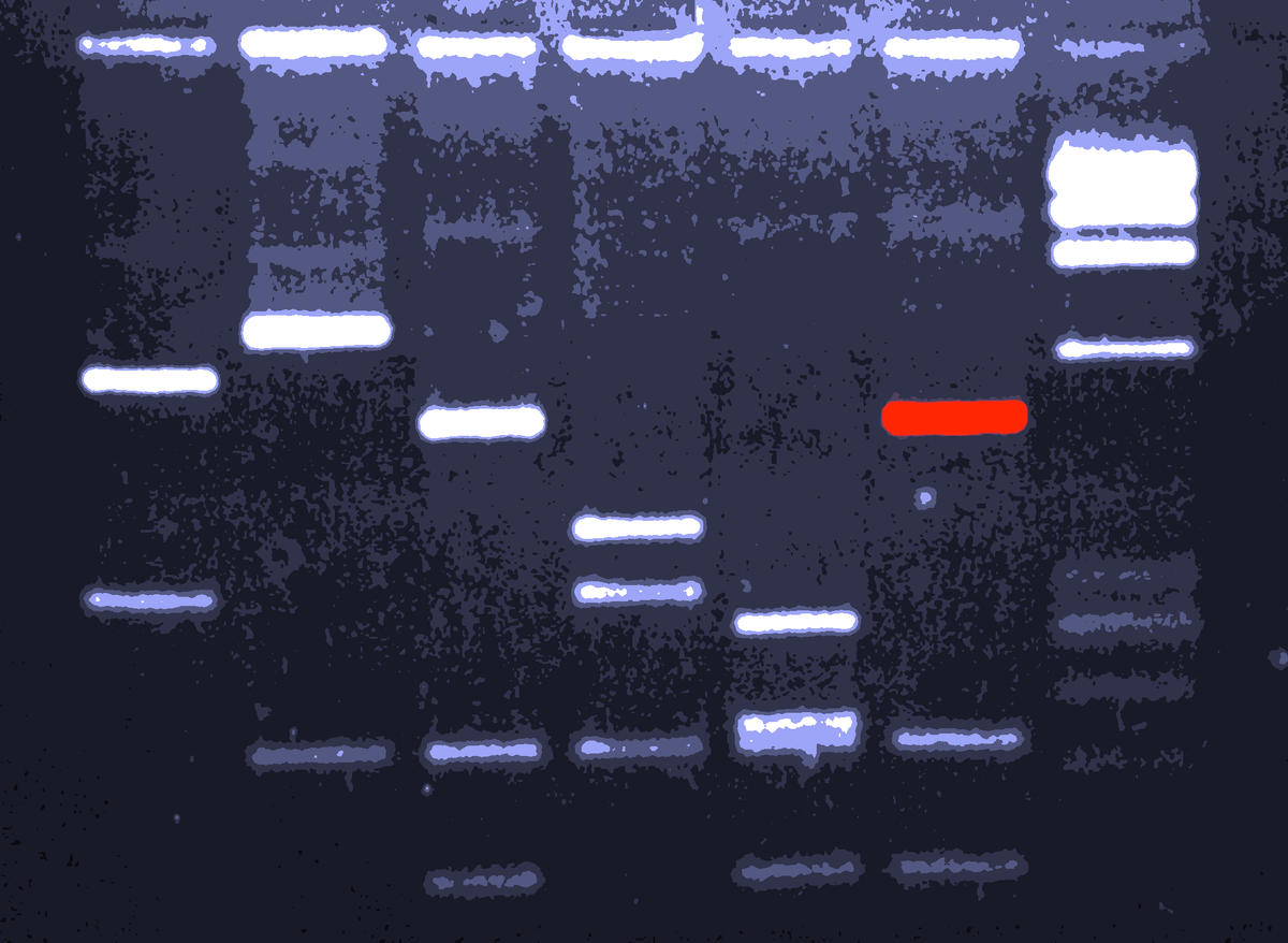 The Surprisingly Imperfect Science of DNA Testing | The Marshall Project
